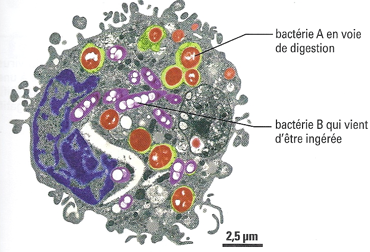 TP18 : La réaction inflammatoire, un exemple de réaction immunitaire ...